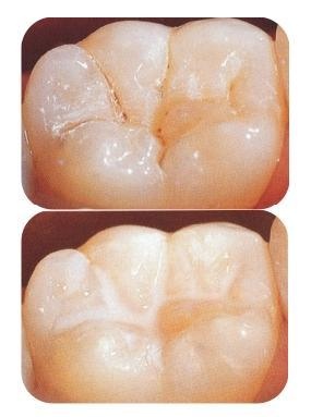 Odontopediatría preventiva - Dentisalut